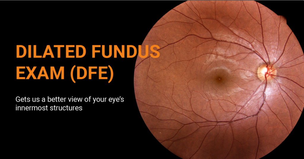 DILATED FUNDUS EXAM (DFE) - Eyecare Plus
